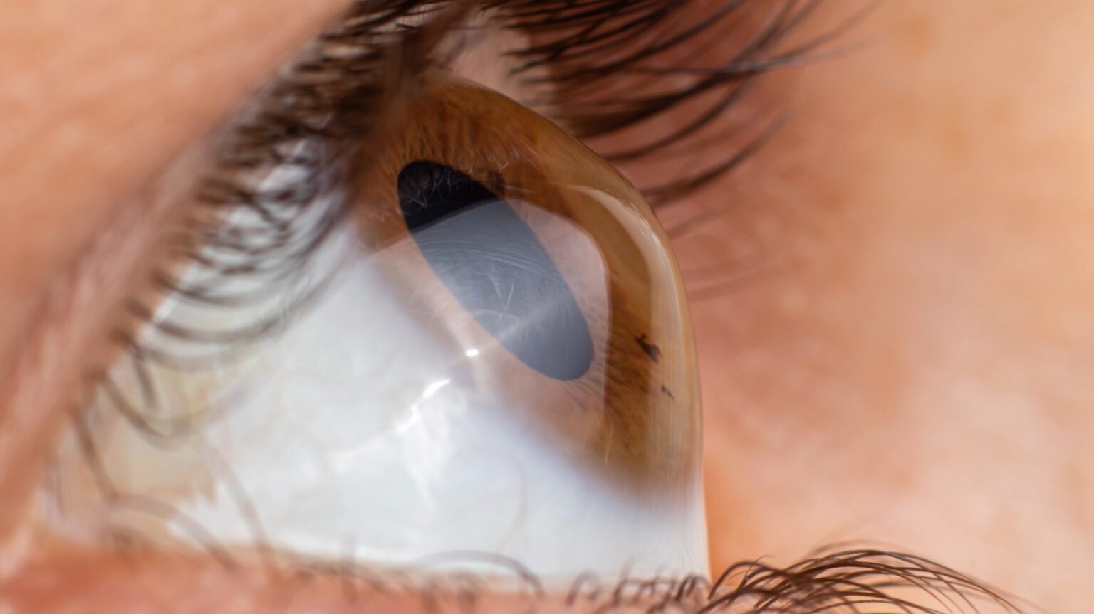 Lentilles rigides – Aeria & AirKone - LCS